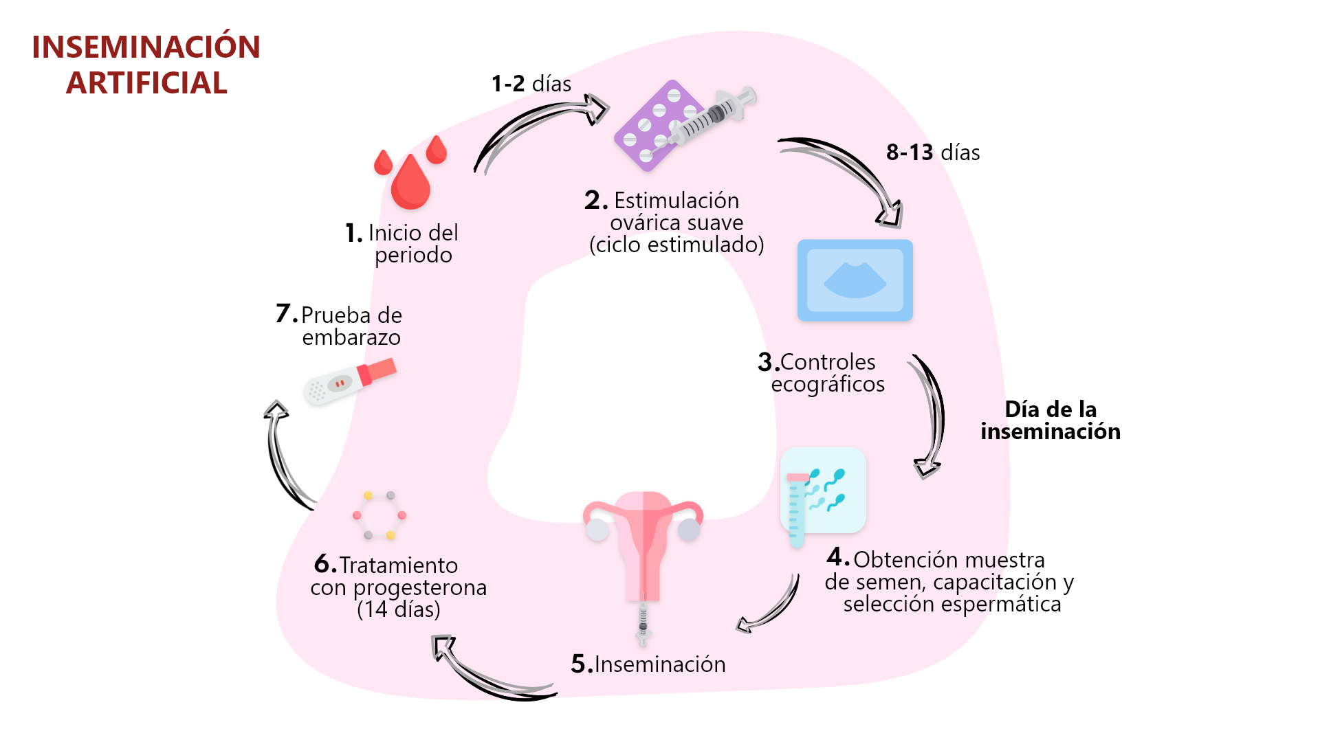 Inseminacion artificial | Clínica ginecología en Zaragoza | AISA FIV
